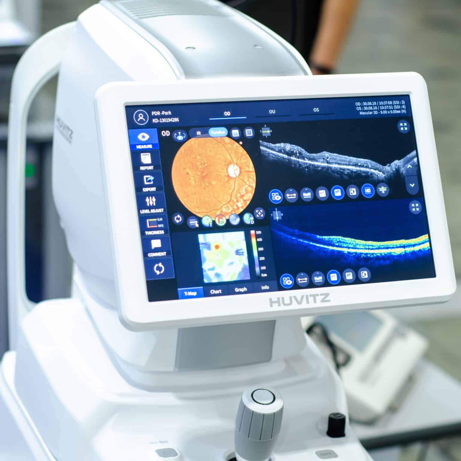 Posterior vitreous detachment Symptoms and Treatment - Clinique VisionPros