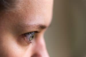Symptômes et traitement de la proptose - Clinique VisionPros