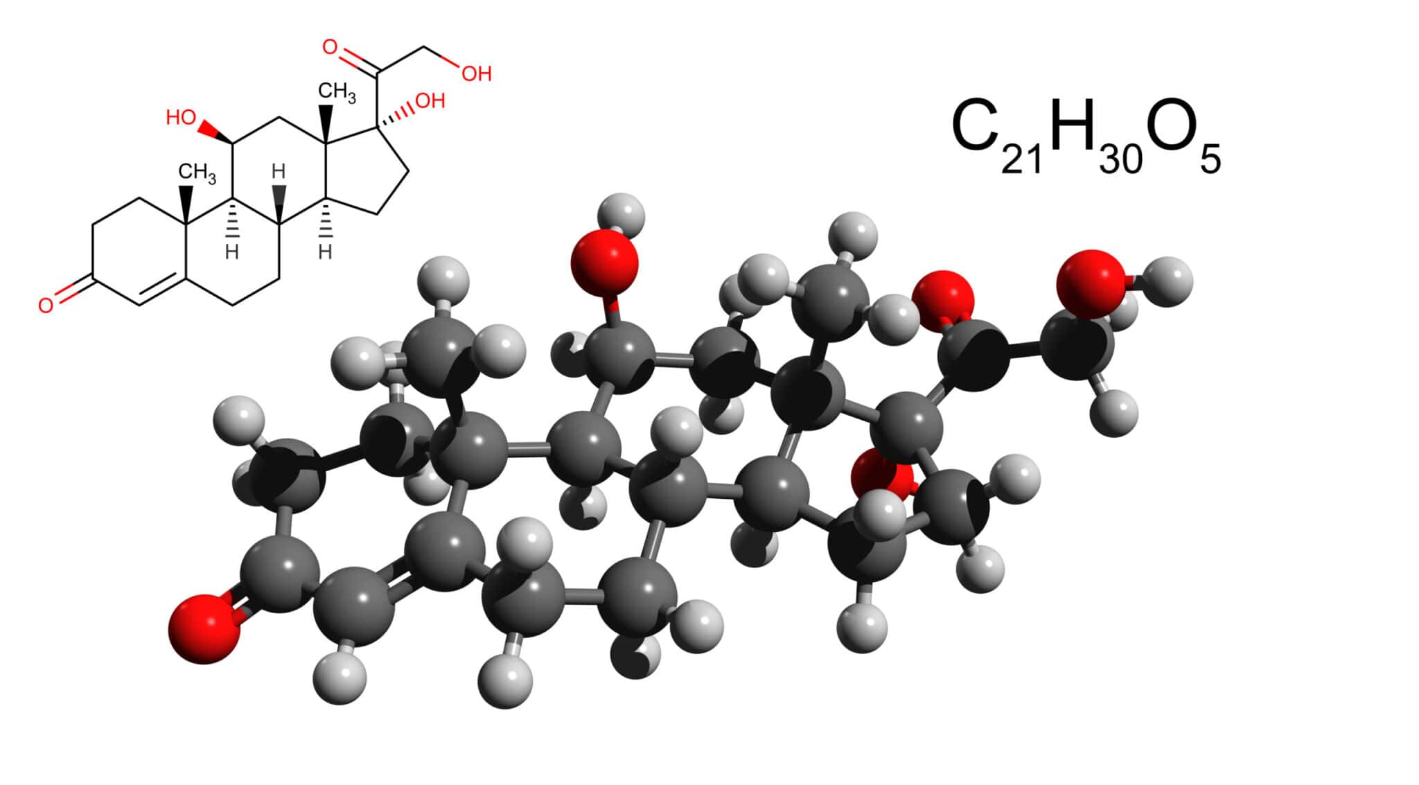 Proptosis Symptoms and Treatment - Clinique VisionPros