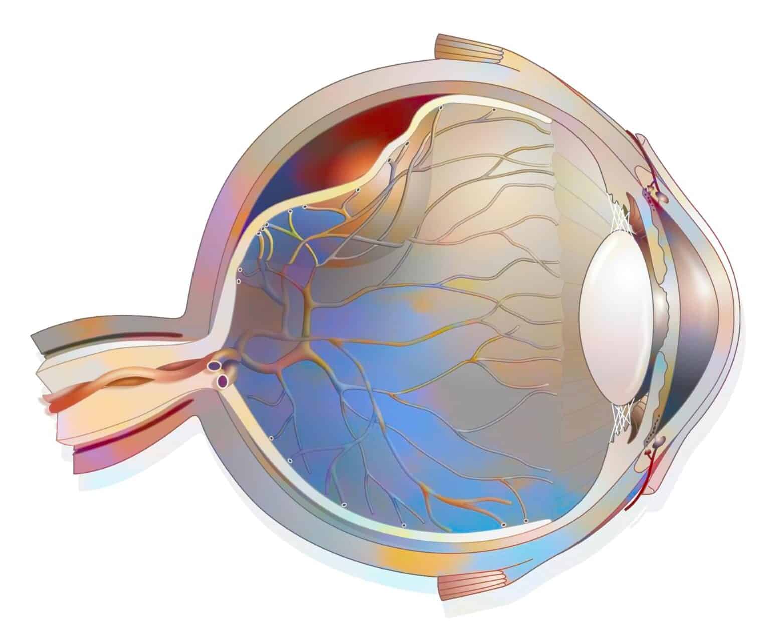 Posterior vitreous detachment Symptoms and Treatment - Clinique VisionPros