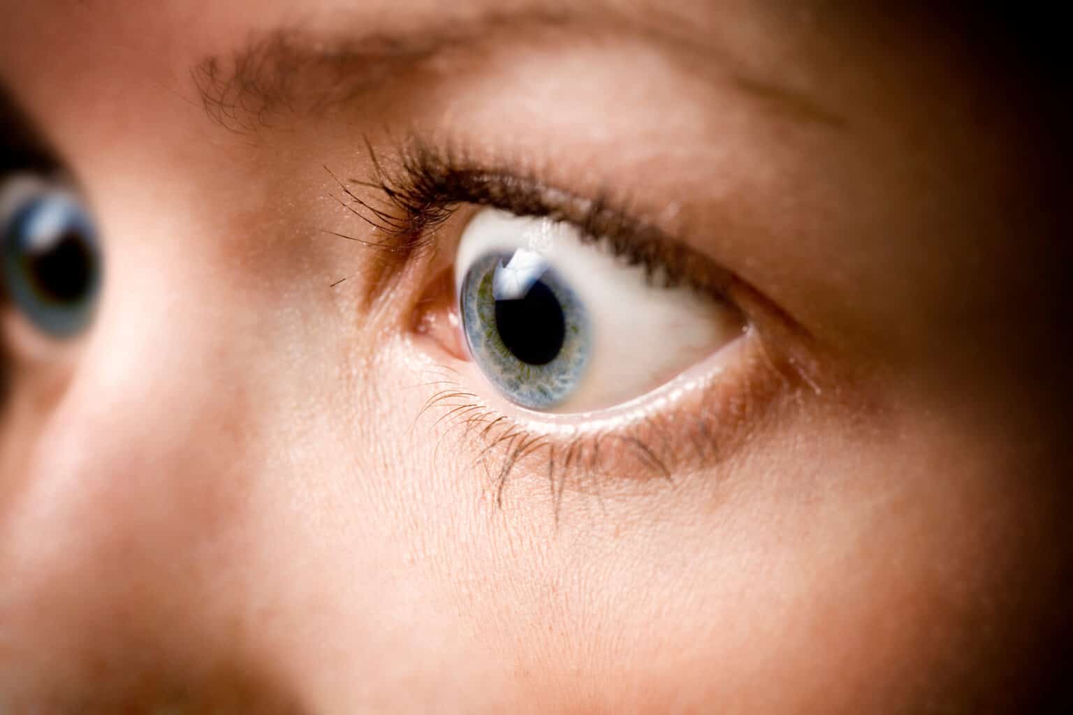 Proptosis Symptoms and Treatment - Clinique VisionPros
