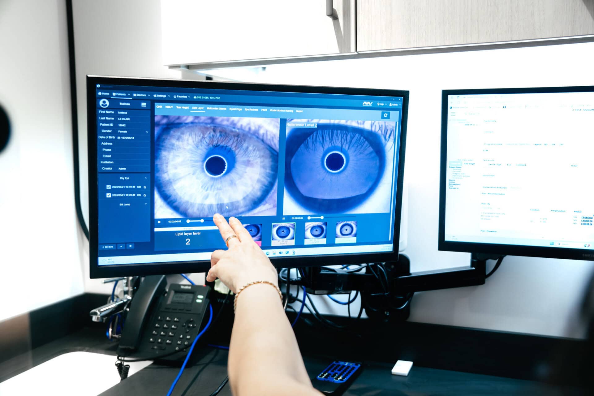 Effective Dry Eye Relief with Radiofrequency Therapy | VisionPros